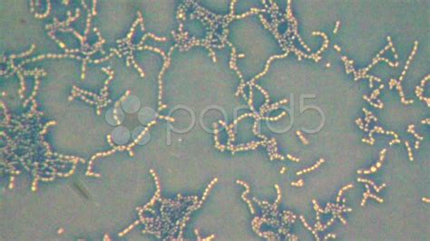 Strep Throat Bacteria Under Microscope