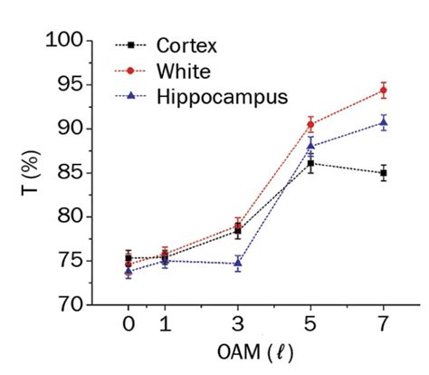 Special Majorana Like Vector Photon Beams Features Feb 2020 Photonics Spectra