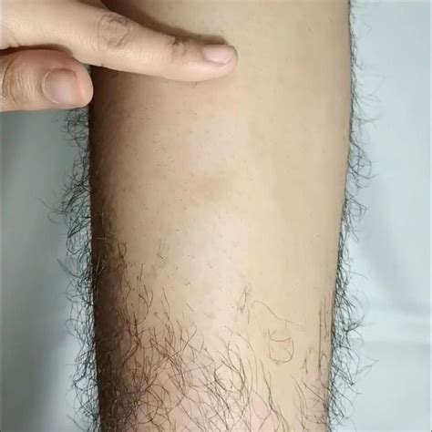 Methods Of Unwanted Hair Removal Hair Removal Spray Unwanted Hair