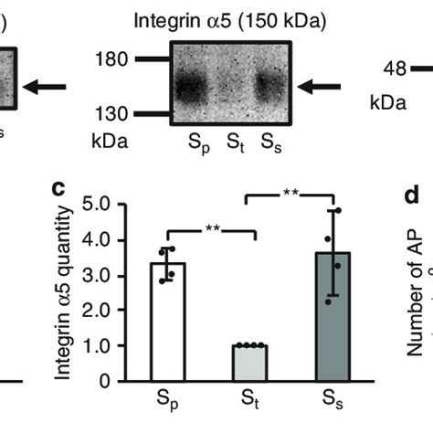The Cell Detachment Device Using Ultrasonic Vibration The Cell