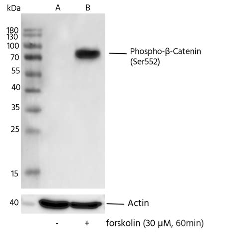 Recombinant Anti Beta Catenin Ser552 Antibody Rabbit Mab 112002