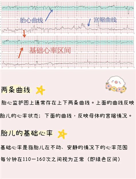 胎心监护报告解析三张图