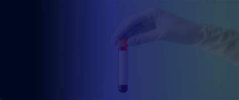 Biochemical Assay Development Biochemical Analysis NorthEast BioLab