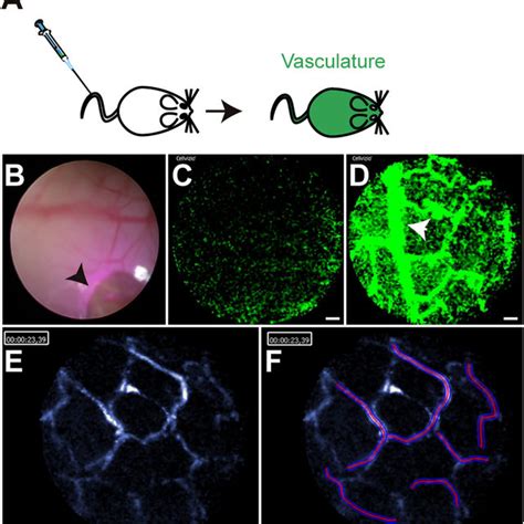 The Dss Induced Acute Colitis Model A Schematic Representation Of Download Scientific