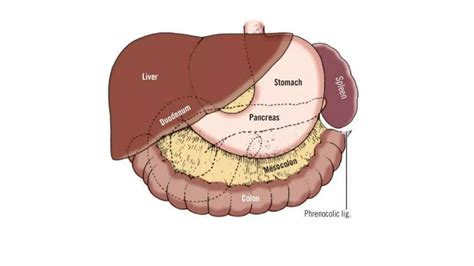 Pancreatic Trauma Pptx