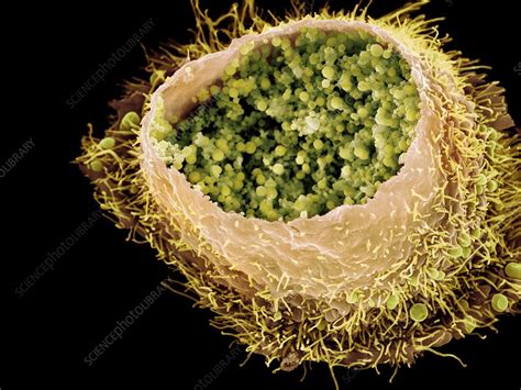 Chlamydia Infection Sem Stock Image C004 9506 Science Photo Library