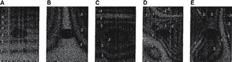 Espi Fringe Patterns At Different Resonance Modes Holed Specimen A Download Scientific