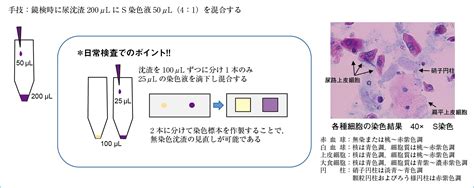尿沈渣検査