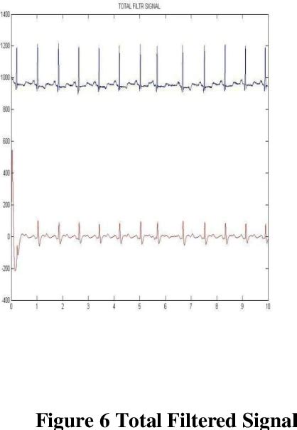 Figure 1 From Design And Analysis Of Electrocardiograph Ecg Signal For Long Term Continuous