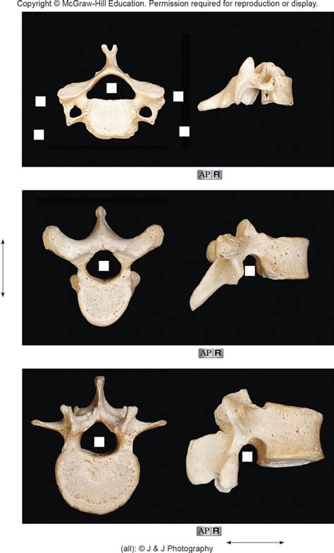 Cervical Thoracic Lumbar Diagram Quizlet