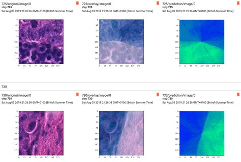 Github Yoavalon Histologyimagesegmentation Semantic Segmentation Of Histopathological Images