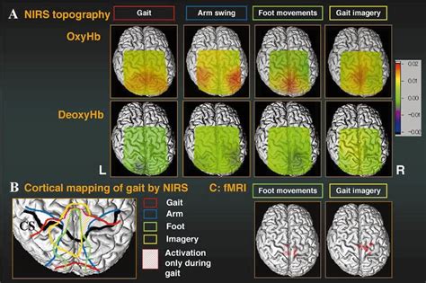An Example Of Cortical Activation Patterns Assessed By Nirs Topography