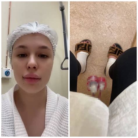 Инстасамка фото до и после пластики биография фото