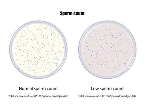 Healthy Semen Color