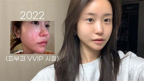 광고 피부과 다녀도 피부 안좋은 사람은 꼭 보세요💁🏻‍♀️💦 내가 피부과vvip 때보다 효과 본 홈케어 방법 7가지🤍ㅣ홈케어 피부관리기기ㅣ피부 케어 루틴 Youtube