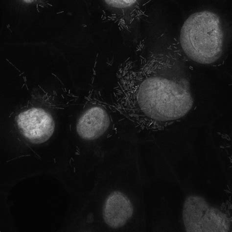 Is This Mycoplasma Contamination Dapi Staining 100x R Labrats
