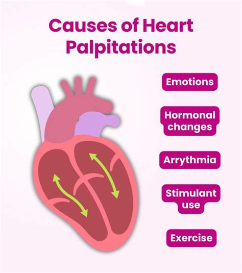 Areeba Nazir On Linkedin About 60 Of The Heart Patients Are From
