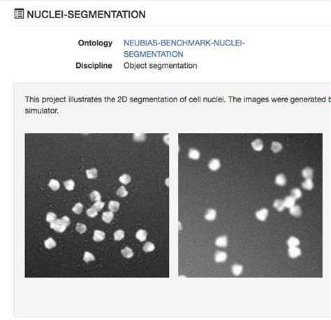 Nuclei Segmentation Cellprofiler Biii