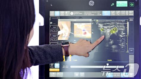 초음파영상진단 장비 설명하는 관계자 뉴스1