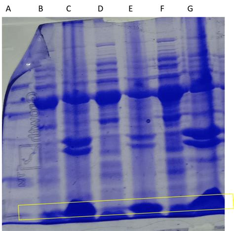 Attempting To Solubilize Protein Why Protein Remains In Pellet Even After Lysis With Detergent