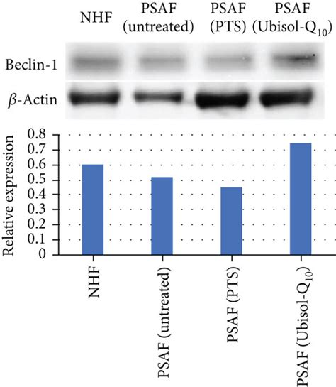 A Autophagy Related Gene Expression Profile For Normal Human