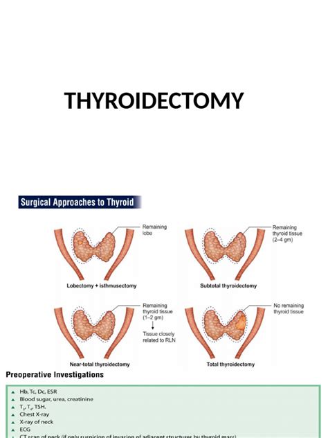 Thyroidectomy Pdf