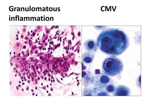 Diagnostic Cytology Introduction Body Fluids Cytology Pptx