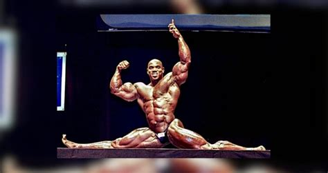 Flex Wheeler Shares He Has Gone Through Well Over 500 600 Surgeries