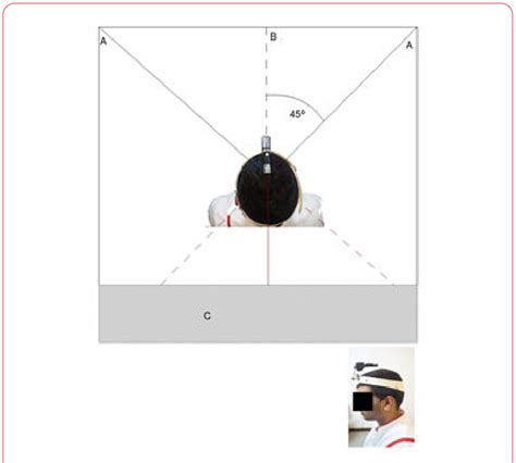 A Setup Of The Laser Pointer On Head Of The Patient And Location Of Download Scientific