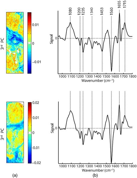Third Pc Of Two Additional Tumor Samples With A Score Values And B Download Scientific
