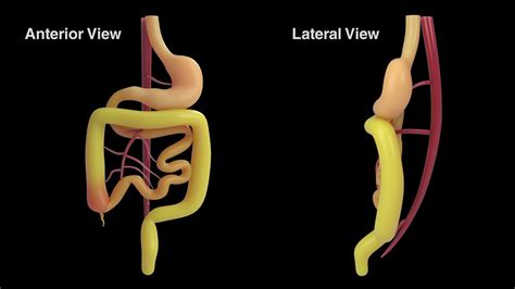 New Revelations In The Pathophysiology And Surgical Management Of