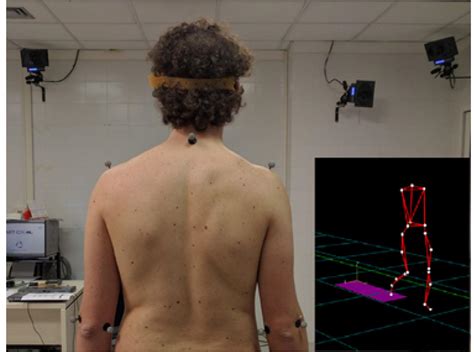 A 3d Acquisition System For Gait Analysis The 3d Skeleton