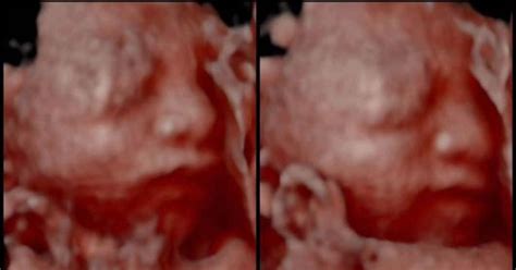 ‘임신 허니제이 뱃속 아기 ‘3d 초음파 사진 공개… “싱기방기”