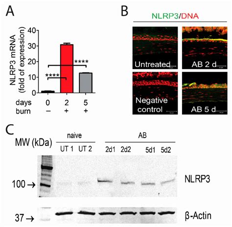 Upregulation Of Nucleotide Binding Oligomerization Domain Containing