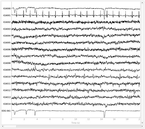 Repairing Artifacts With Ica — Mne 1 1 1 Documentation