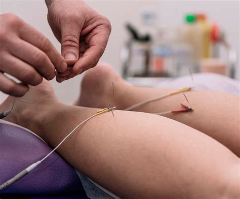 Neuromodulación Fisio Fochtman