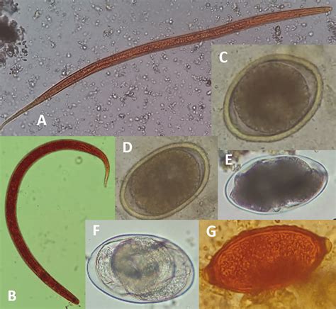 Hookworm Eggs Under Microscope