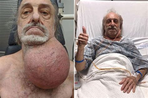 Tiny Scab On Mum S Nose That She Ignored For A Year Was Deadly Skin Cancer Mirror Online