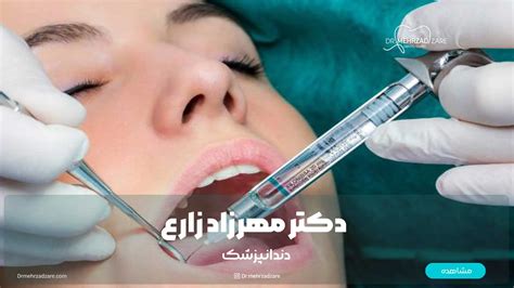 آمپول بی حسی دندان؛ کاربرد، عوارض و نشانه‌های حساسیت دندان پزشکی دکتر