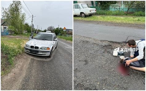 На Дніпропетровщині авто збило хлопчика дитина у лікарні з важкими травмами Читайте на Ukr Net