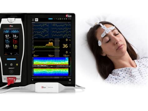 Masimos Sedline Parameters Predict Outcomes Post Cardiac Arrest