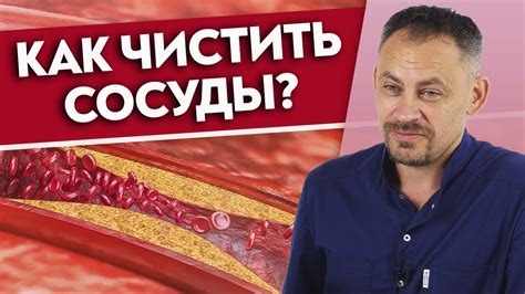 Как снизить ХОЛЕСТЕРИН? | Опасные заболевания сердца и сосудов | Плохой ...