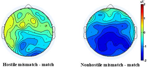 Topographic Maps Of Mean Erp Differences Waveforms Erp Mismatch Minus Download Scientific