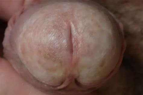 Close Up Penis 14 Pics Xhamster