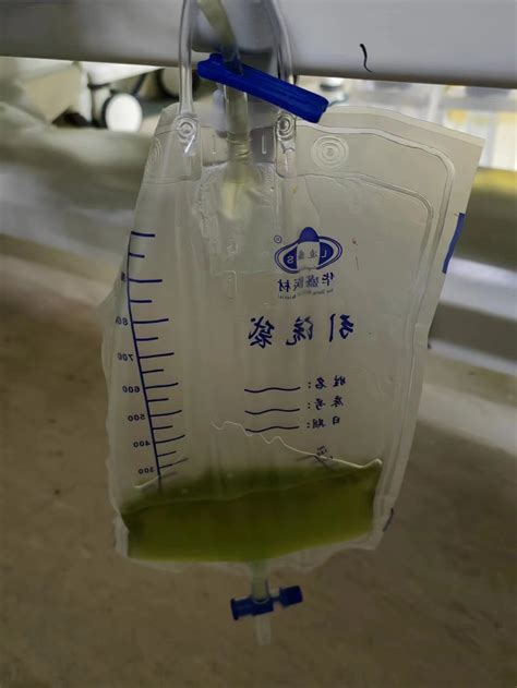 尿液绿色 贪吃的夜猫子