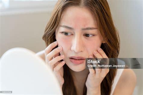 젊은 여성 아시아 얼굴이 걱정됩니다 피부과와 화장품의 스테로이드에 알레르기가 있습니다 민감한 피부 햇볕에 탄 붉은 얼굴 여드름 화학 물질에 알레르기 얼굴에 발진 피부
