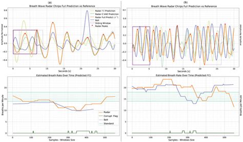 Few Shot User Adaptable Radar Based Breath Signal Sensing