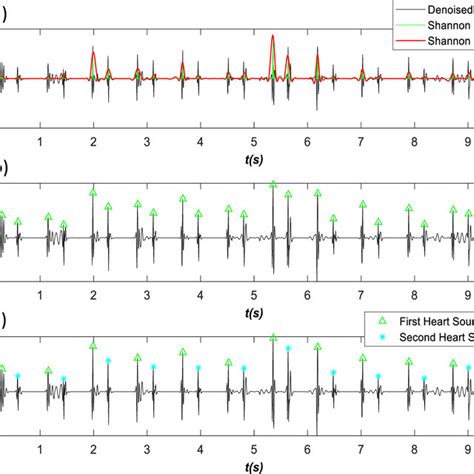 The Process Of Peak Detection And Identification Of The Pcg Signal A Download Scientific