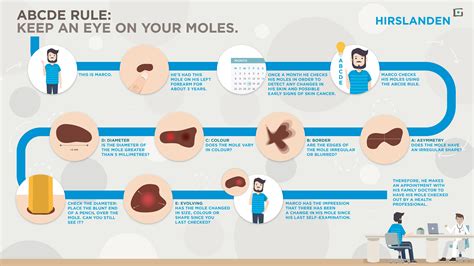 Melanoma Symptoms Diagnosis And Treatment Hirslanden