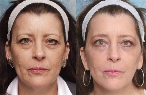 Пин на доске Косметология